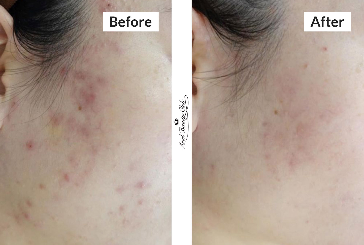 DMK Enzyme Therapies - Sydney