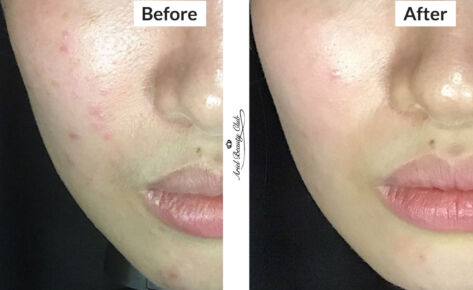 DMK Enzyme Therapies - Sydney