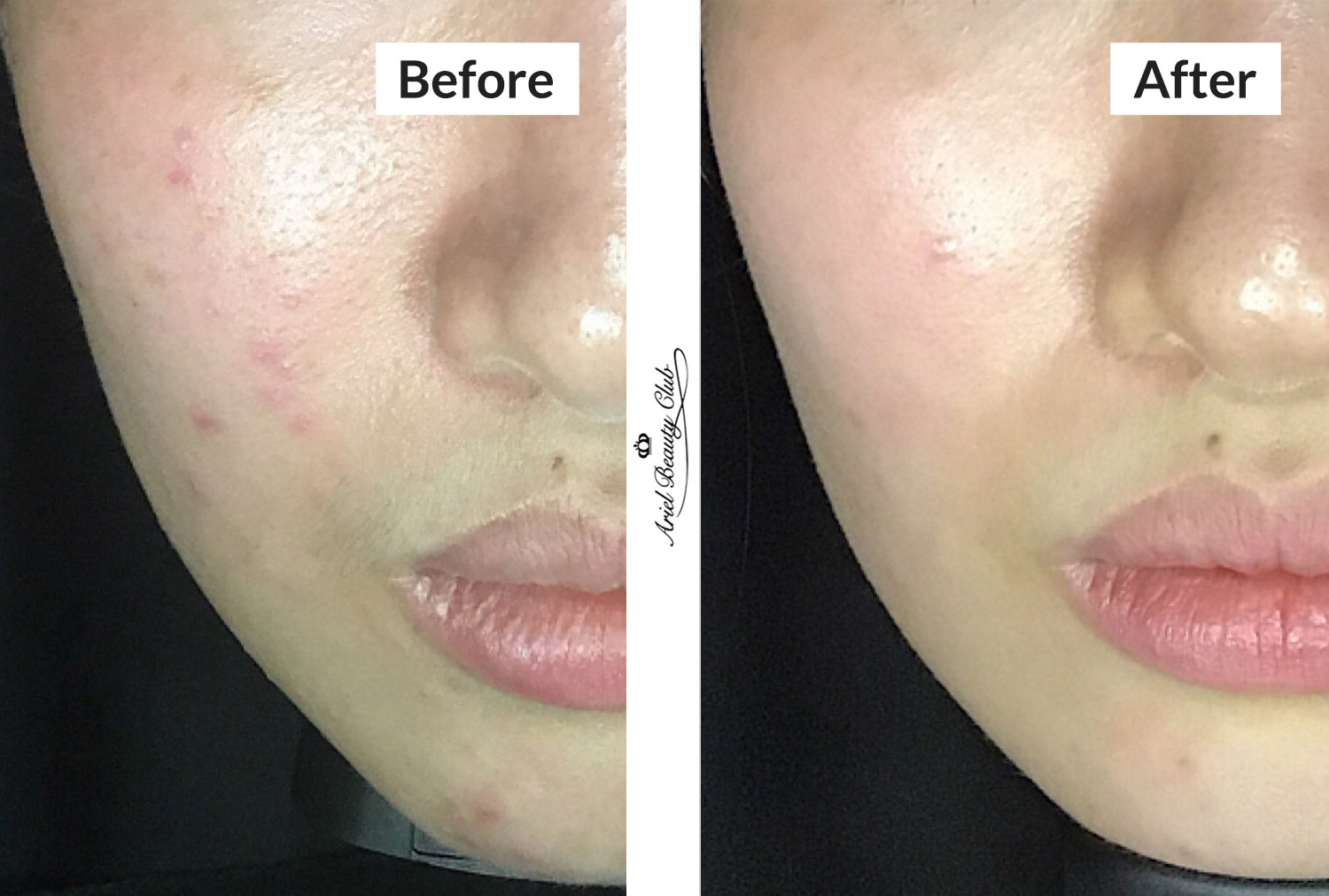 DMK Enzyme Therapies - Sydney